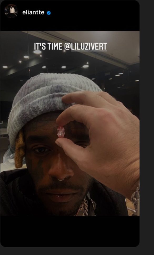 Lil Uzi Vert implants a $24 million diamond in his forehead